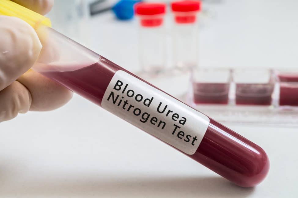 BLOOD UREA VIP Lab BLOOD UREA VIP Lab